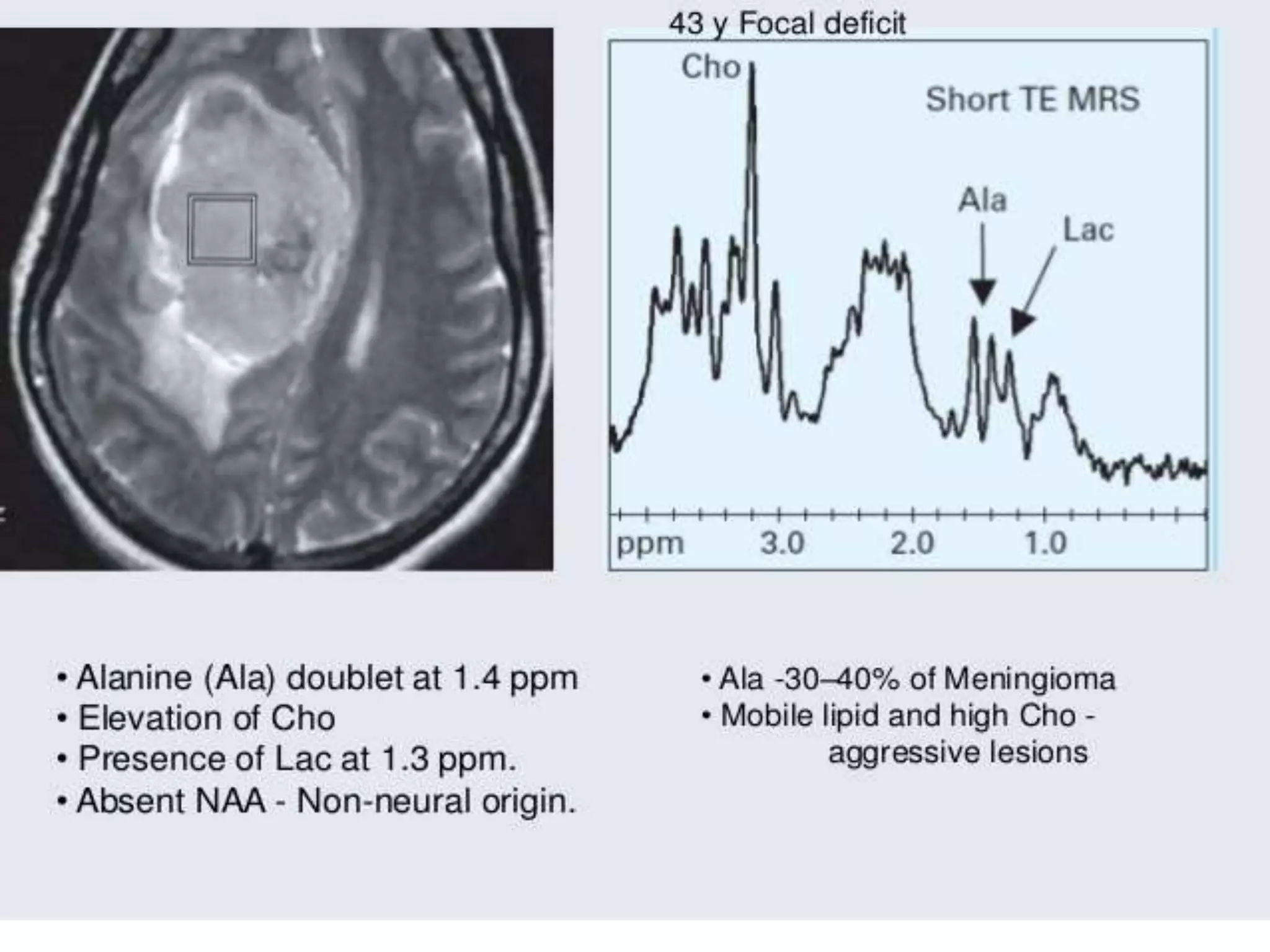 Mrs basic principles and clinical applications of magnetic resonance ...
