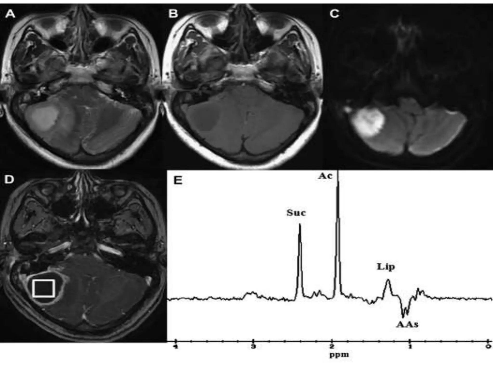 Mrs basic principles and clinical applications of magnetic resonance ...