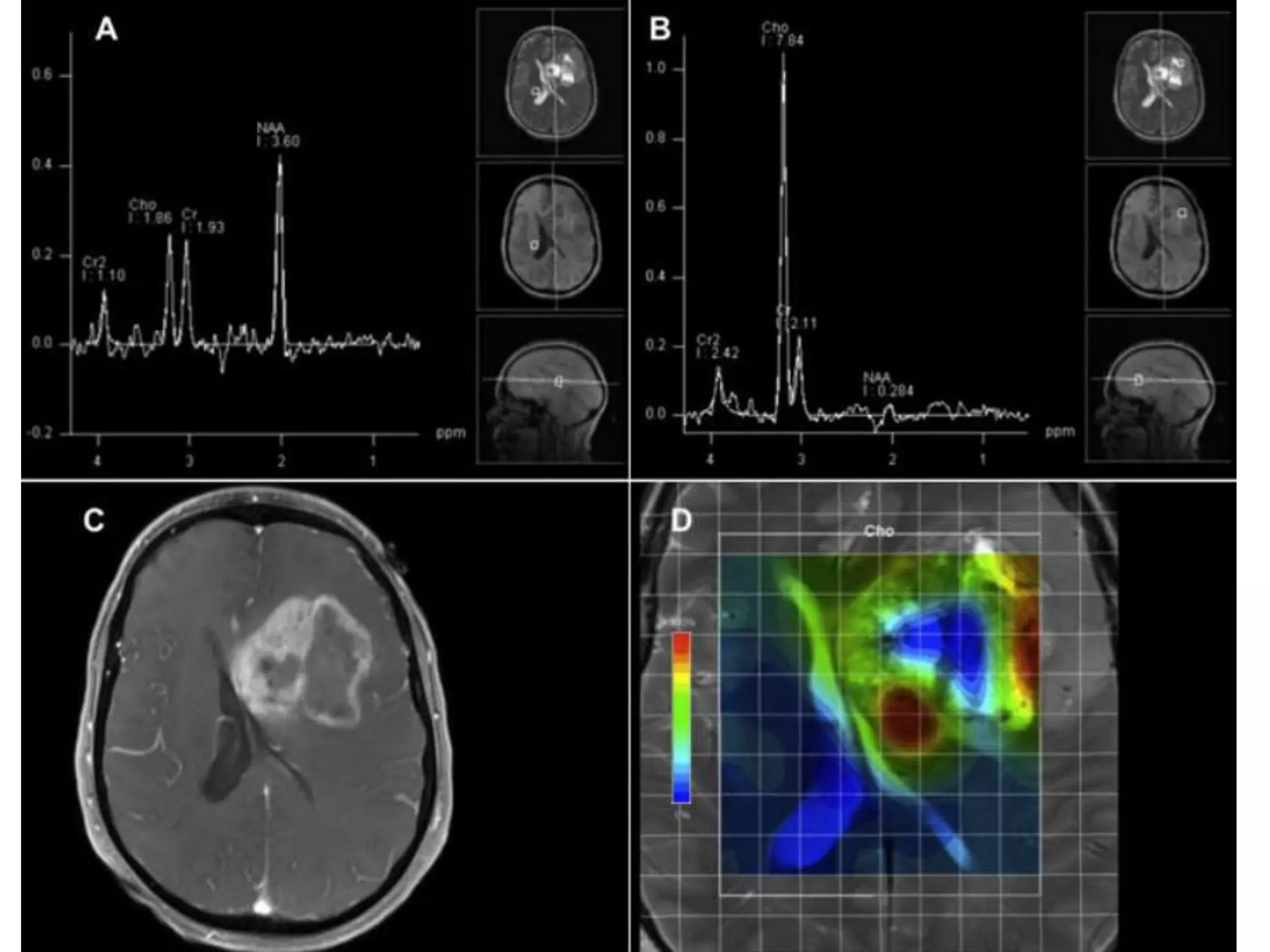 Mrs basic principles and clinical applications of magnetic resonance ...