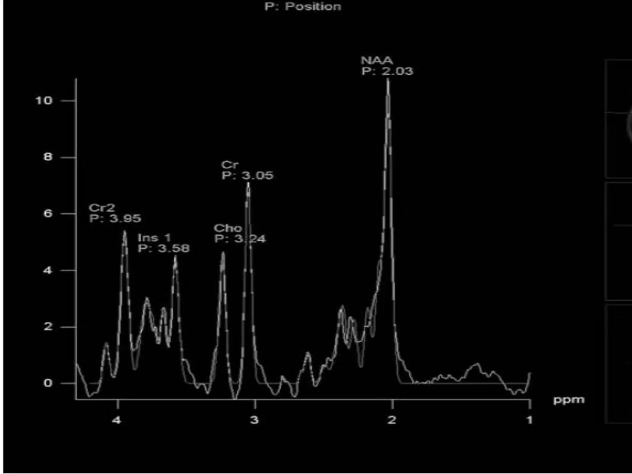 Mrs basic principles and clinical applications of magnetic resonance ...