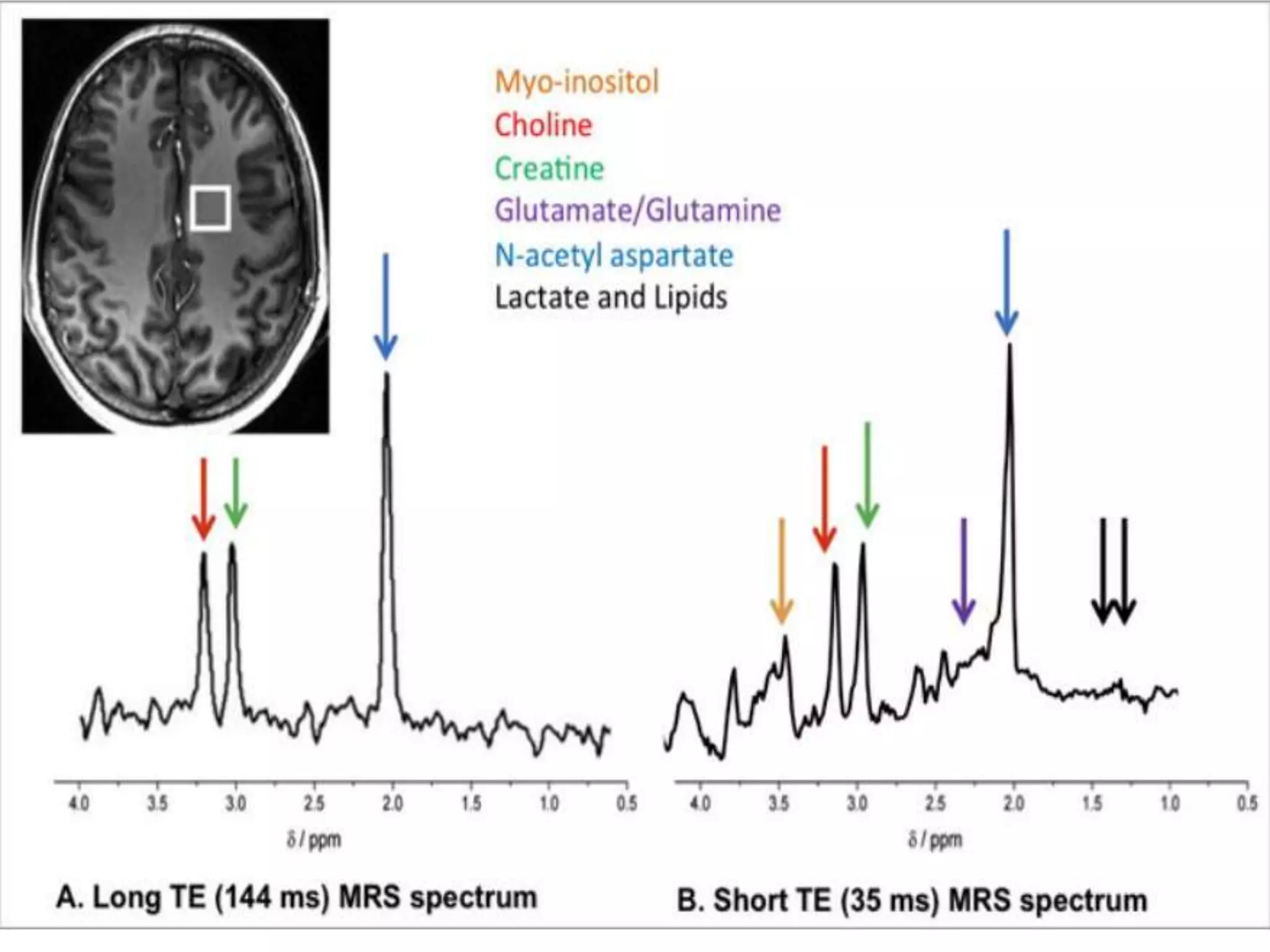 Mrs basic principles and clinical applications of magnetic resonance ...