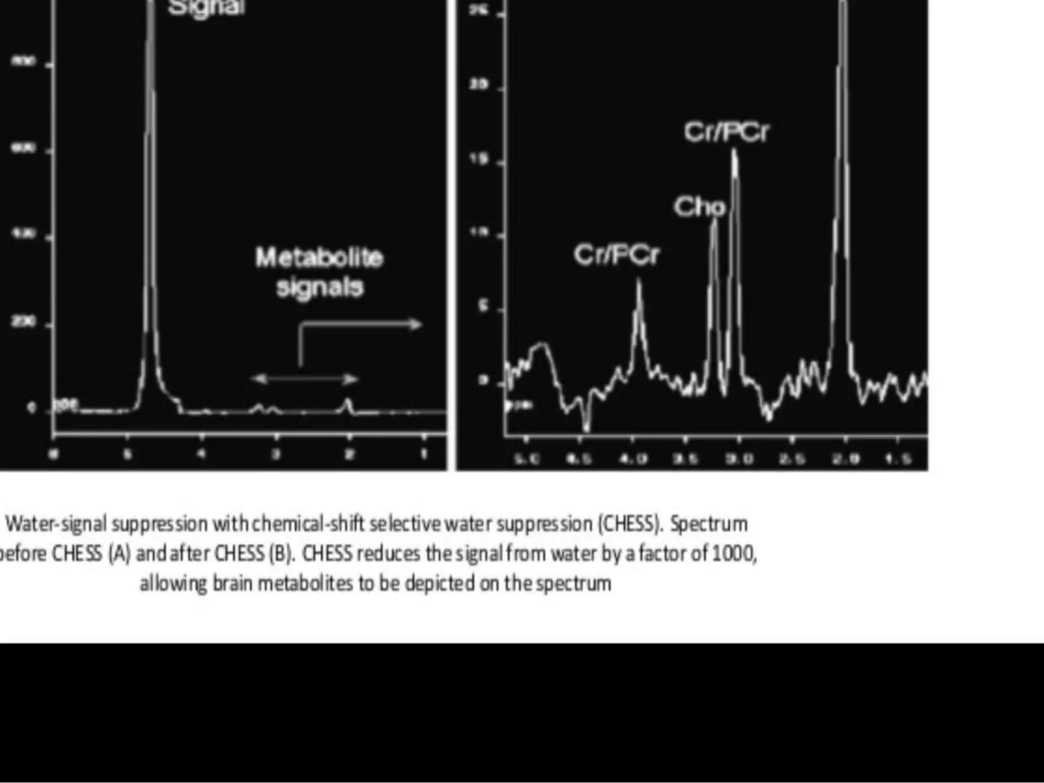Mrs basic principles and clinical applications of magnetic resonance ...
