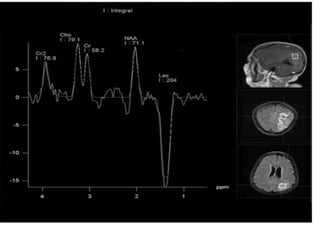 Mrs basic principles and clinical applications of magnetic resonance ...