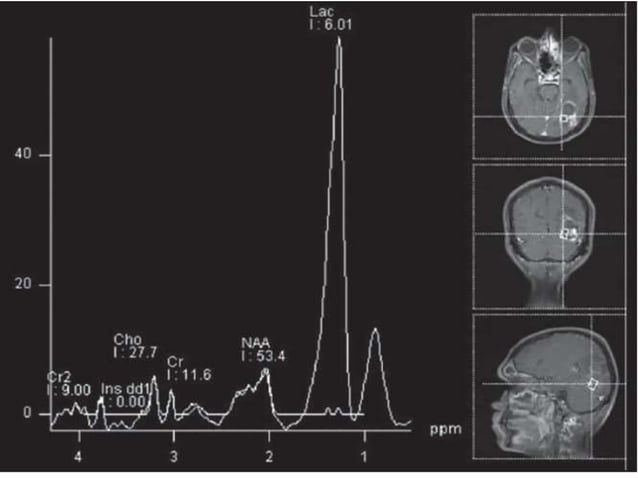 Mrs basic principles and clinical applications of magnetic resonance ...