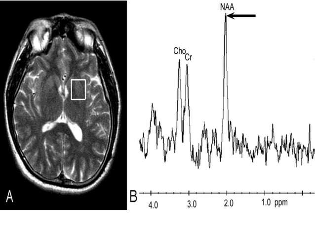 Mrs basic principles and clinical applications of magnetic resonance ...