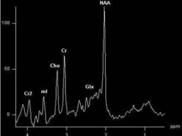 Mrs basic principles and clinical applications of magnetic resonance ...