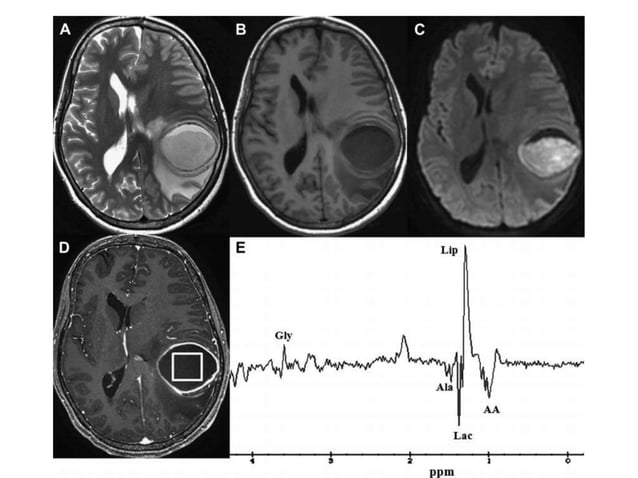 Mrs basic principles and clinical applications of magnetic resonance ...