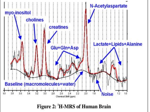 Mrs basic principles and clinical applications of magnetic resonance ...