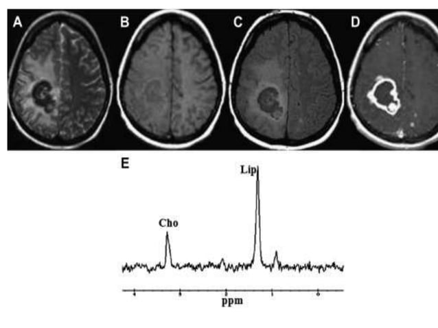 Mrs basic principles and clinical applications of magnetic resonance ...