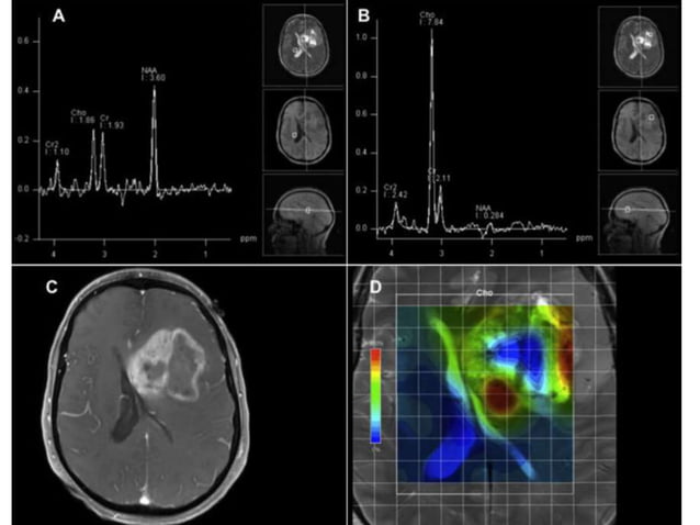 Mrs basic principles and clinical applications of magnetic resonance ...