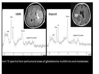 Mrs basic principles and clinical applications of magnetic resonance ...