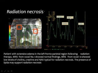 Mrs basic principles and clinical applications of magnetic resonance ...