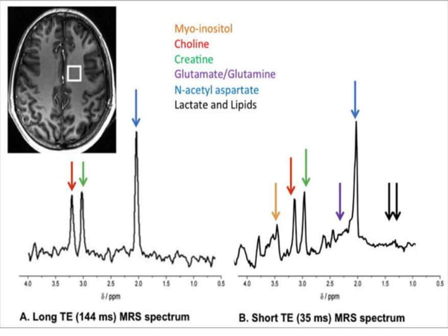 Mrs basic principles and clinical applications of magnetic resonance ...