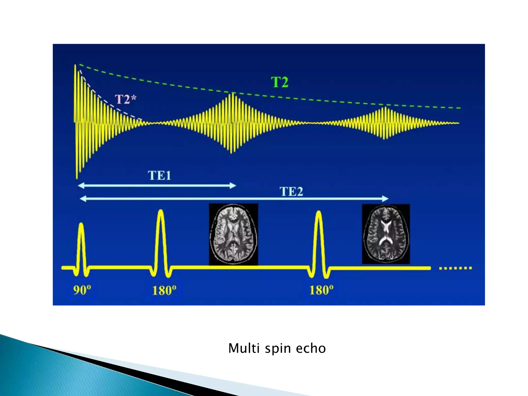 BASIC MRI SEQUENCES | PPTX