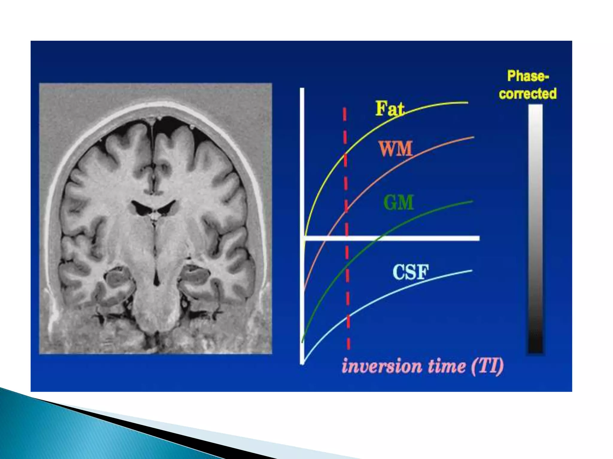 BASIC MRI SEQUENCES | PPTX