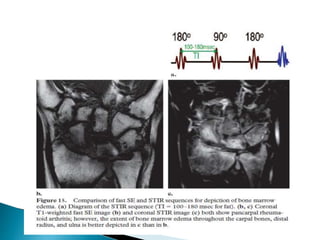 BASIC MRI SEQUENCES | PPTX