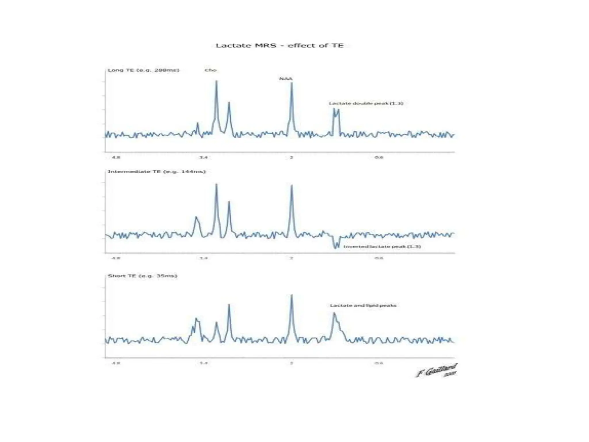 MRS magnetic resonance spectroscopy IN CNS.pptx