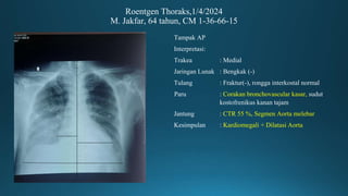 MR Slide Heart Failure April 2024 an M Jakfar.pptx