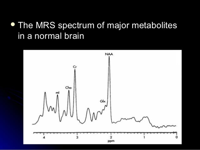 Mr spectroscopy