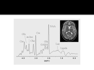 MR spectroscopy | PPTX