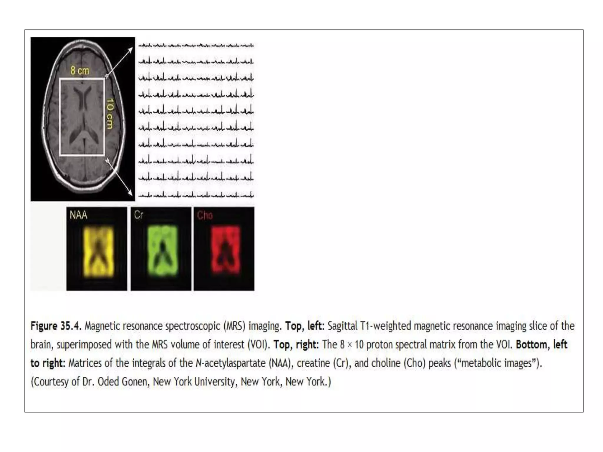 MR Spectroscopy | PPTX