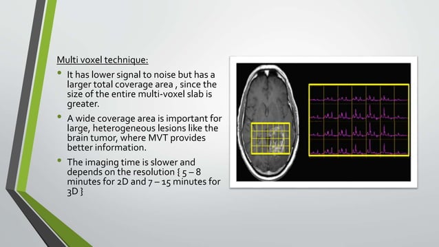 Mr spectroscopy | PPT