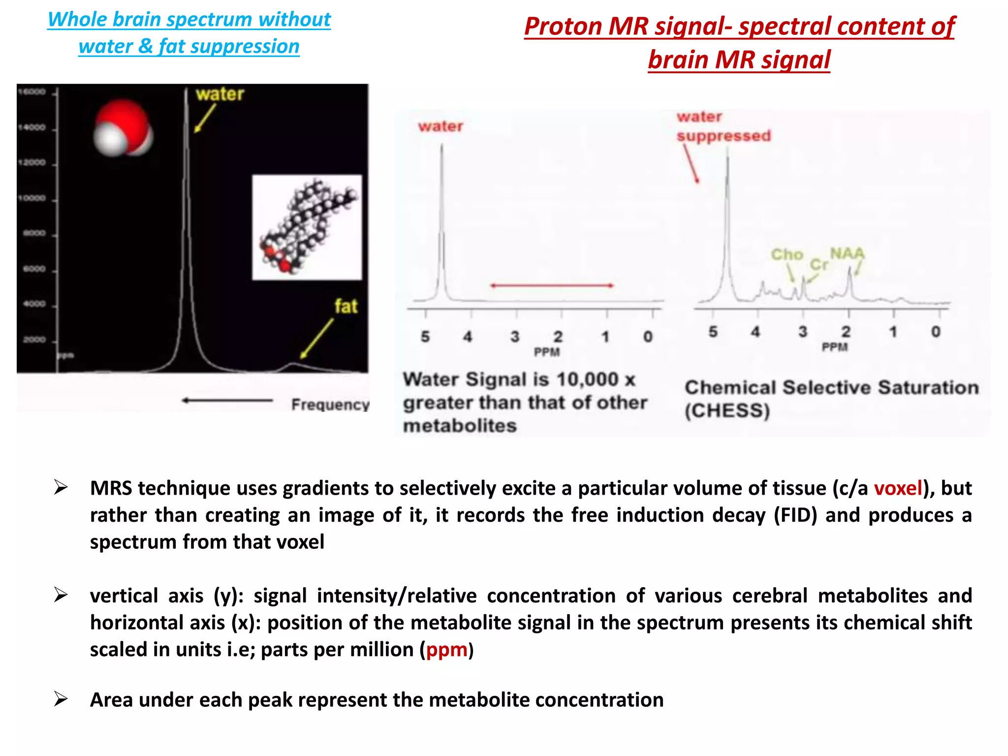 MR spectroscopy | PPTX
