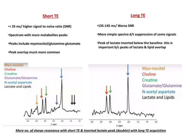 MR spectroscopy | PPTX | Medical Tests | Medical Health