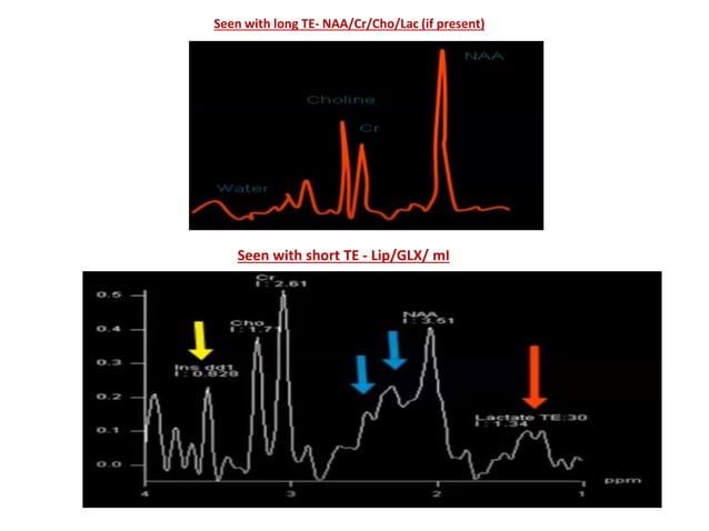 MR spectroscopy | PPTX | Medical Tests | Medical Health