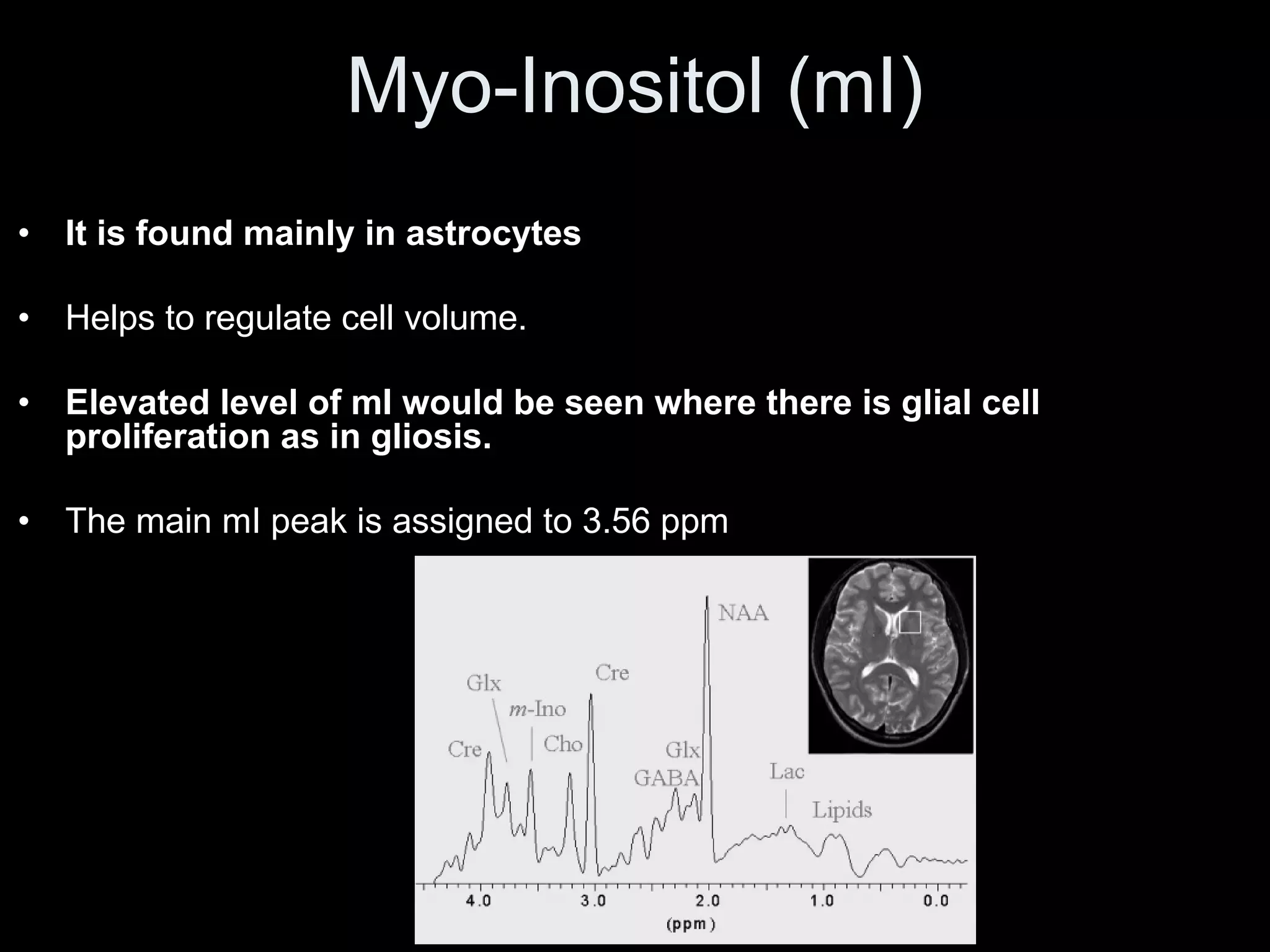 Mr spectroscopy abdulj original final1 | PDF