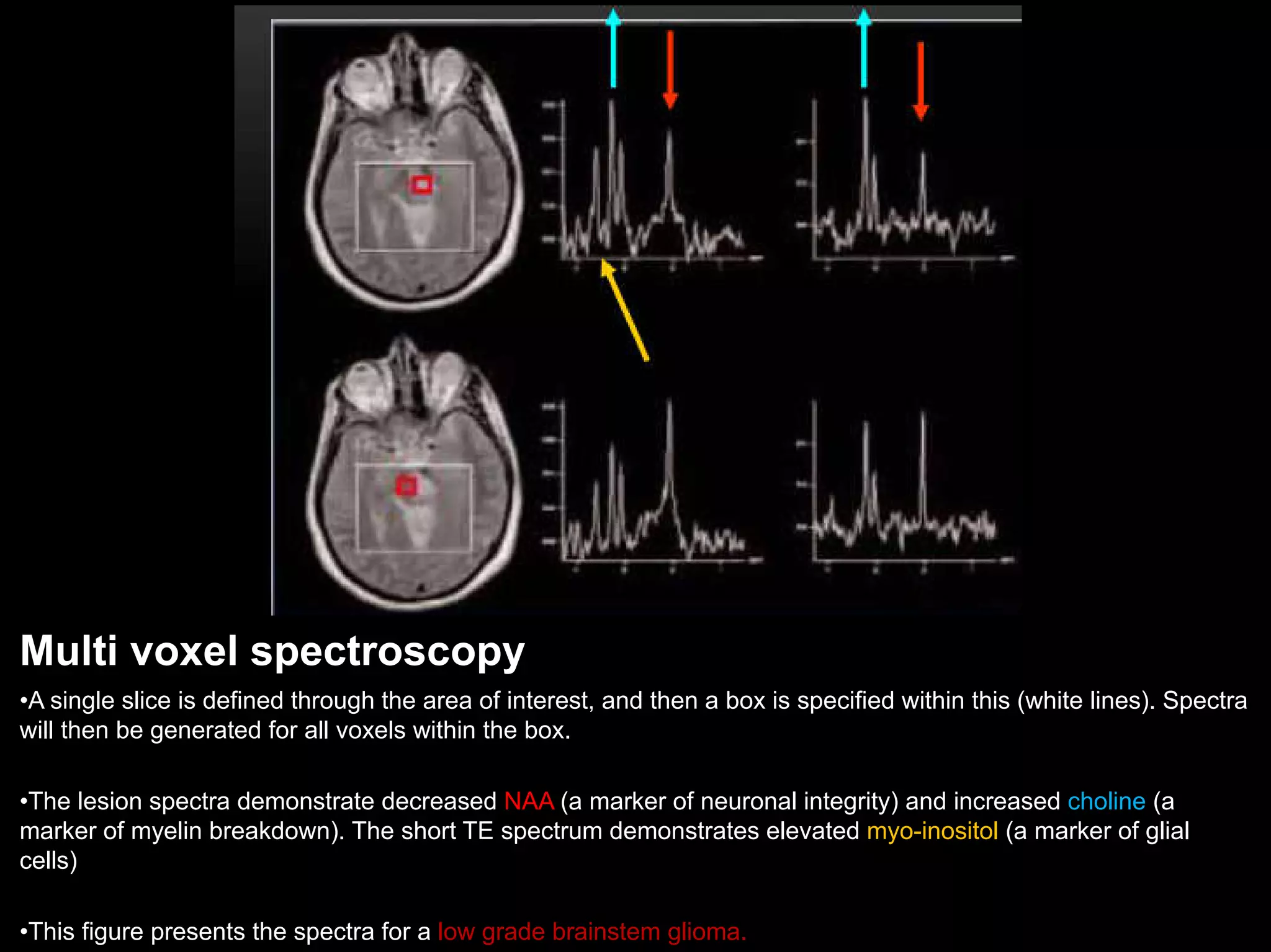Mr spectroscopy abdulj original final1 | PDF