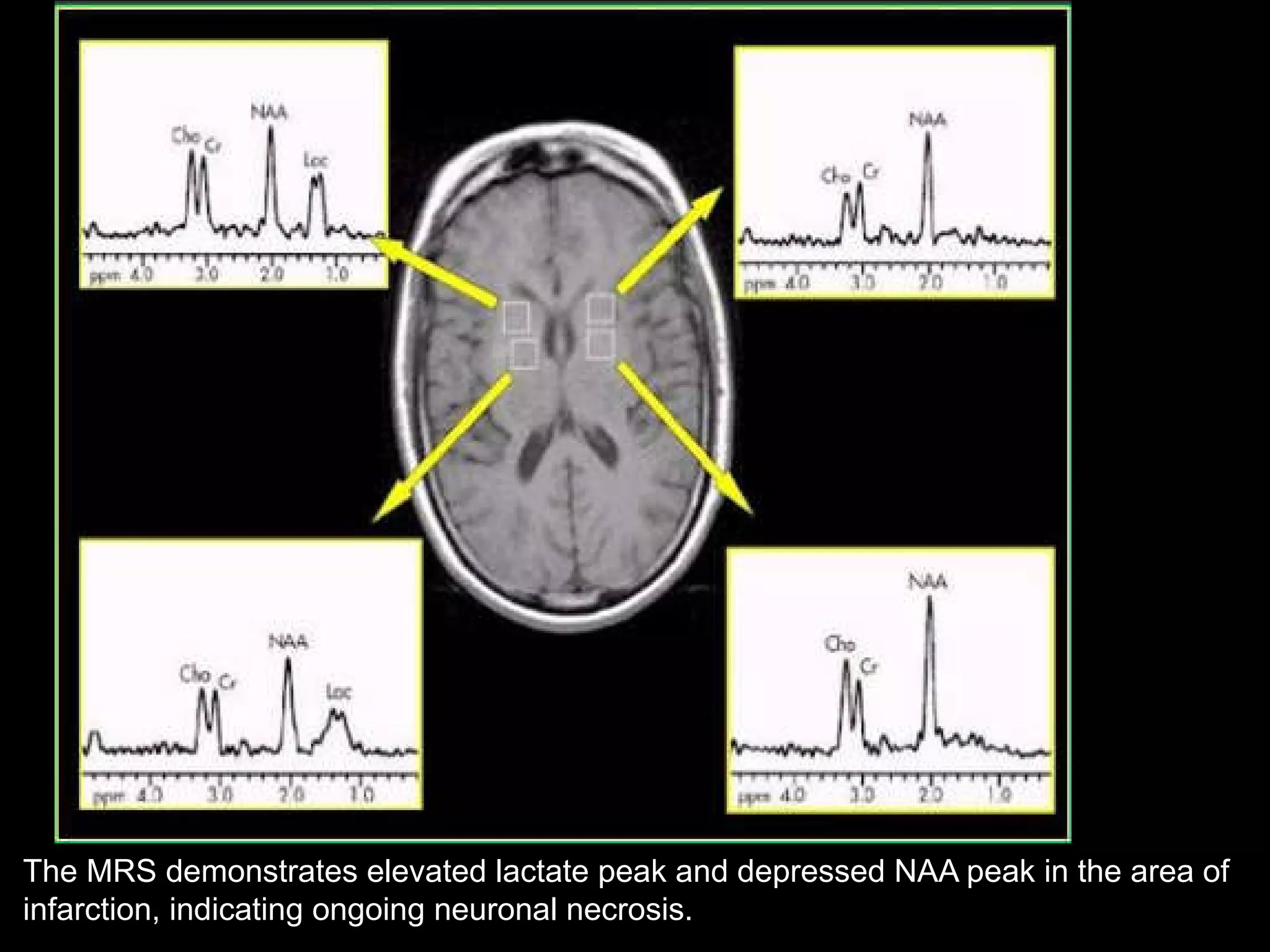 Mr spectroscopy abdulj original final1 | PDF