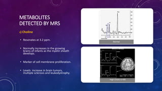 Magnetic resonance spectroscopy | PPTX
