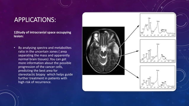 Magnetic resonance spectroscopy | PPTX