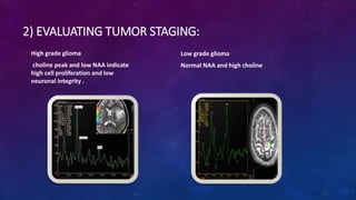 Magnetic resonance spectroscopy | PPTX
