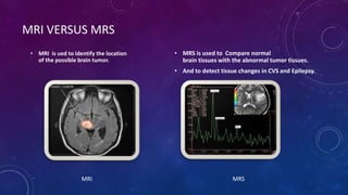 Magnetic resonance spectroscopy | PPTX