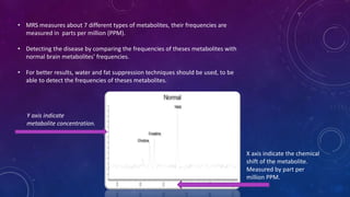 Magnetic resonance spectroscopy | PPTX