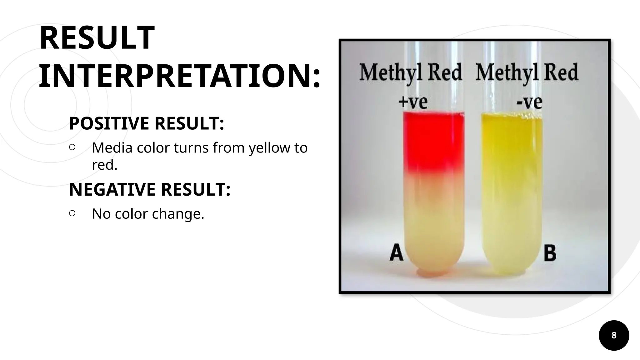 MRVP test Biochemical Test presentation ppt.pptx