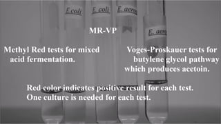 MRVP test Biochemical Test presentation ppt.pptx