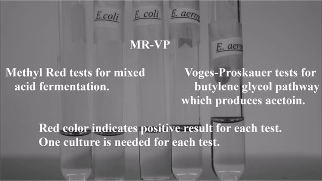 MRVP test Biochemical Test presentation ppt.pptx