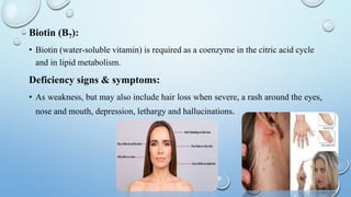 Role of vitamins in metabolism (1) | PPTX