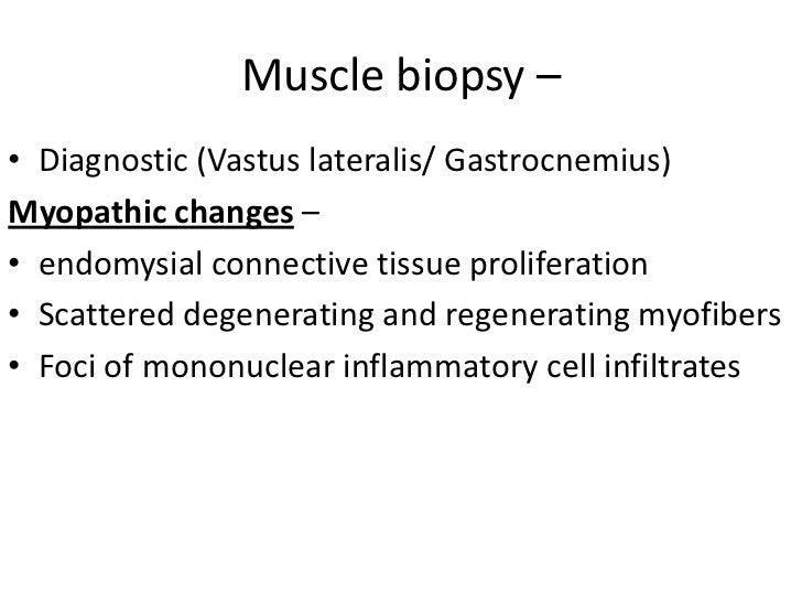 Muscular Dystrophy : Duchenne and Becker's