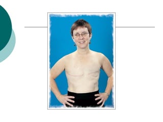 Breast Reconstruction - Jane Rothwell | PPT | Cancer | Diseases and ...