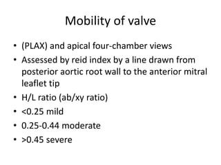 Mitral stenosis Echocardiography | PPTX