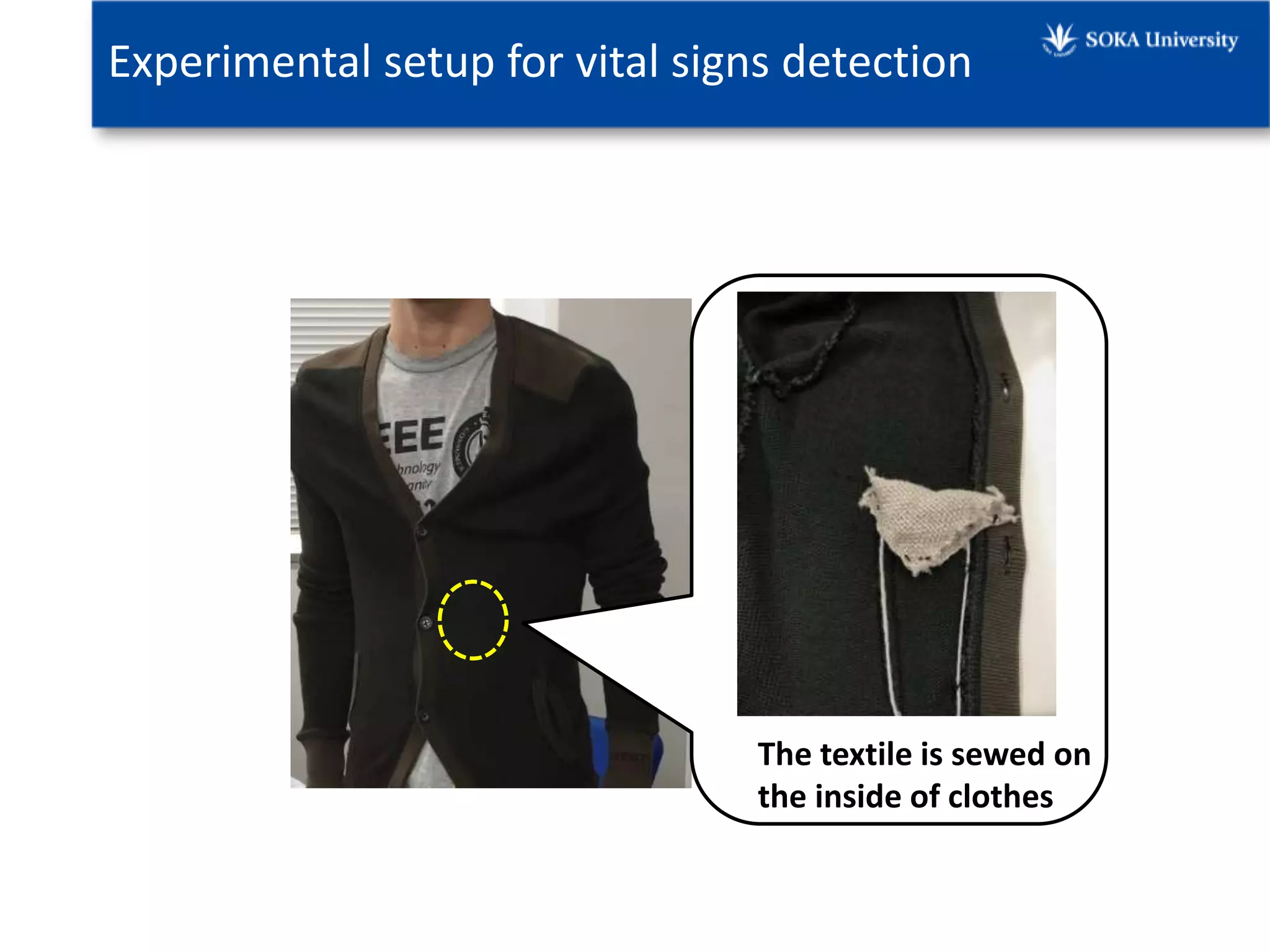 Smart sensing textile with embedded hetero-core optical fiber sensors ...