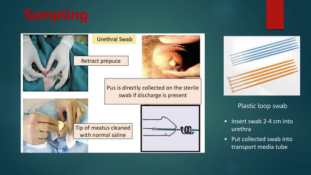modified syndromic approach for sexaully transmitted disease | PPTX