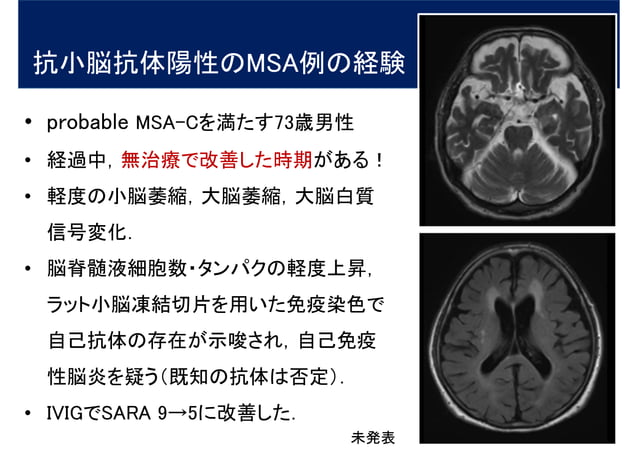 MSA update 2022.pdf | Brain and Nervous System Disorders | Diseases and ...
