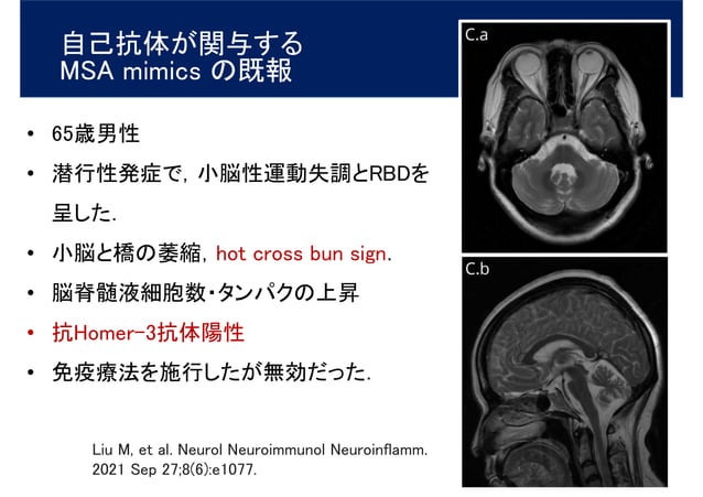 MSA update 2022.pdf | Brain and Nervous System Disorders | Diseases and ...