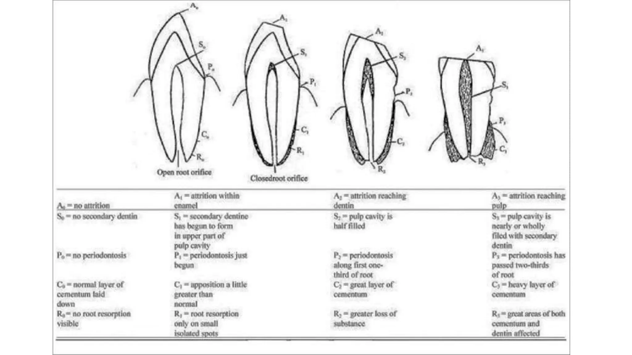 Msciii Forensic Anthropology Age Estimation Using Dentition Pptx