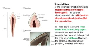 MSCIII_Forensic anthropology_age estimation using dentition.pptx